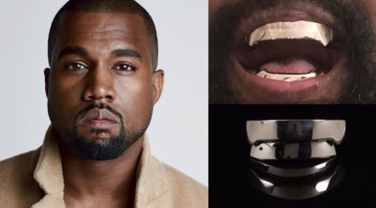 Kanye West's Bold New Dental Transformation: Titanium Dentures - Kiksee ...